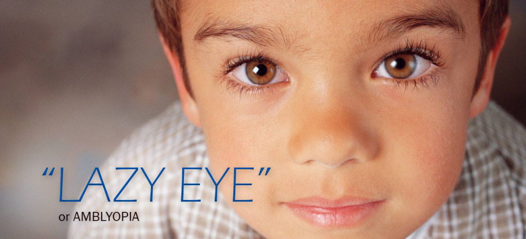 What is LAZY EYE? How to TREAT it? – Eye & Glasses